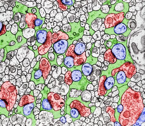 Synapses In Cerebellar Cortex Tem Stock Image C060 1048 Science Photo Library