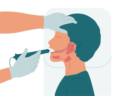 330 Kelenjar Liur Ilustrasi Grafik Vektor And Clip Art Bebas Royalti