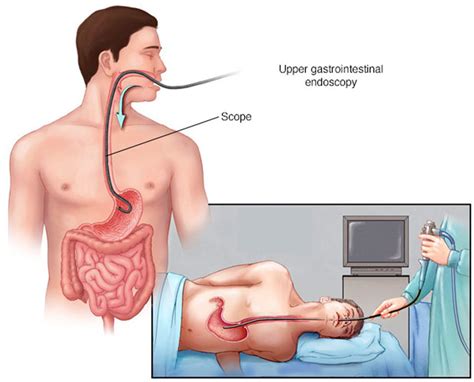 Endoscopy Prep Risks And Endoscopy Procedure