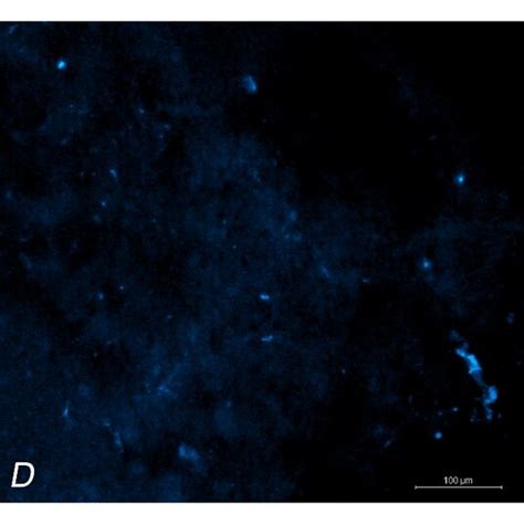 Tangential Corneal Topography Maps In A Patient Who Underwent Download Scientific Diagram