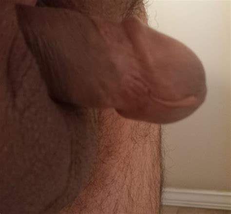 Small Circumcised Cock 6 Pics Xhamster