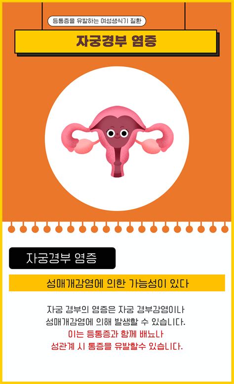 등 통증을 유발하는 여성생식기 질환 Hihy 건강저장소 포스트 한양대학교병원