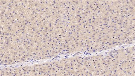 Oas1 Monoclonal Antibody C5 Ma5 43642