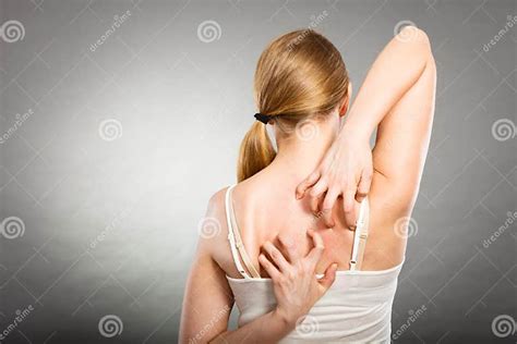 Woman Scratching Her Itchy Back With Allergy Rash Stock Image Image