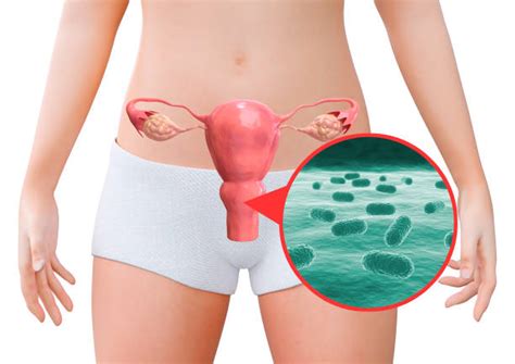 Decoding Bacterial Vaginosis Causes Symptoms Diagnosis And Treatme