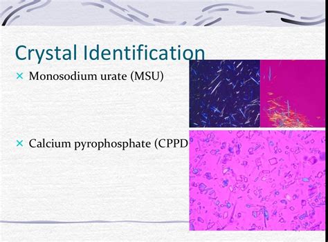 Clinical Applications Of Synovial Joint Fluid Analysis