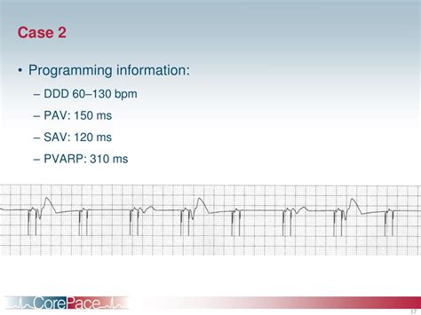 Ppt Pacemaker Troubleshooting Module 9 Powerpoint Presentation Free