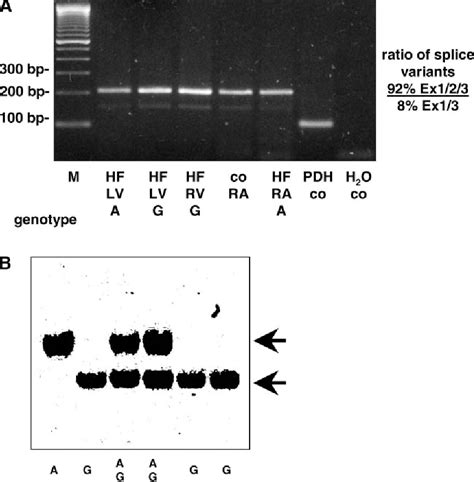 [pdf] Intronic Ang Ii Type 2 Receptor Gene Polymorphism 1675 G A Modulates Receptor Protein