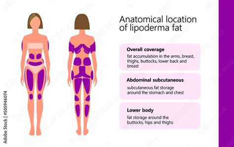 Anatomical Location Of Lipoderma Fat In Woman Body Vector Illustration
