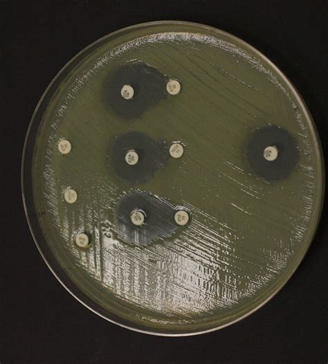Ceftazidime Avibactam Caz Avi And Carbapenem Disc Diffusion