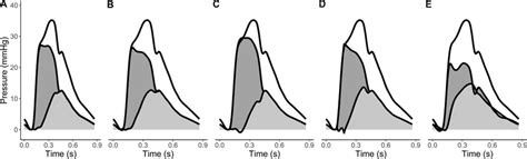 Examples Of Wave Seperation Performed Using Measured And Estimated Flow Download Scientific