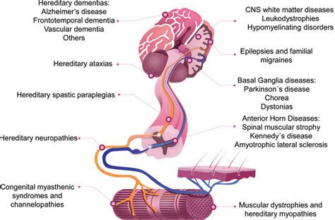 Major Groups Of Neurogenetic Conditions According To The Topographical