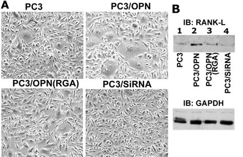 Analysis Of The Effects Of Opn Over Expression On Cell Morphology And
