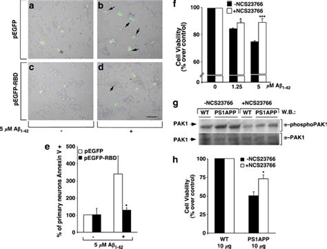 142 β Amyloid Aβ142 Peptide Induced Apoptosis In Primary Cultures