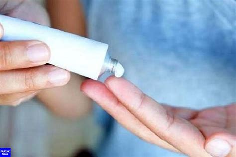 قارچ پوستی چیست؟ علائم، علل و راه های درمان سریع آن