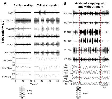 Volitional Modulation Of Standing And Assisted Stepping A Time