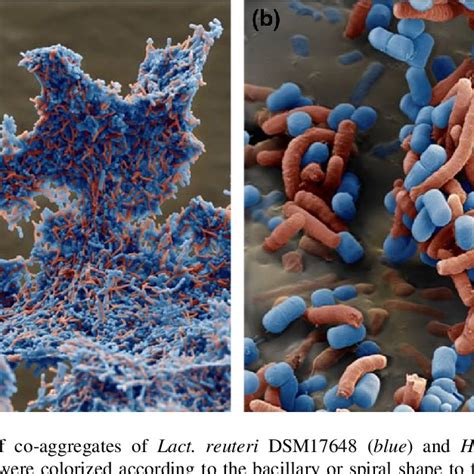 Pdf Significant Reduction In Helicobacter Pylori Load In Humans With Non Viable Lactobacillus