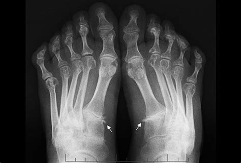 19 Common Foot Disorders