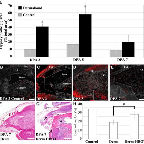 Pdf Epidermal Closure Regulates Histolysis During Mammalian Mus