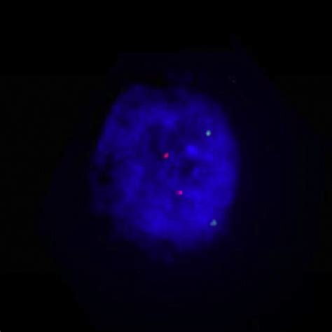 Fluorescence In Situ Hybridization Analysis Of Uncultured Interphase