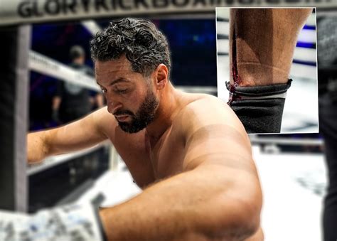 Jamal Ben Saddik Vecht Tegen Tranen In Ahoy Diepe Snee Beëindigt