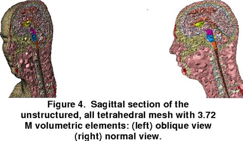 Figure 1 From Developing A Finite Element Head Model For Impact