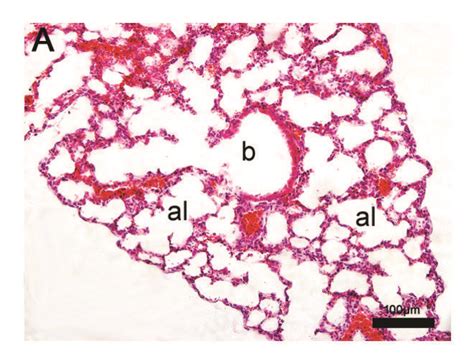 Histopathological Analysis Of Mice Lung Tissue Nontreated Balbc Mice