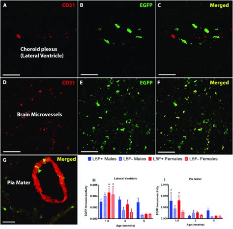 Monocytes Enter The Brain Parenchyma Through The Ventricles Choroid Download Scientific Monocytes Enter The Brain Parenchyma Through The Ventricles Choroid Download Scientific