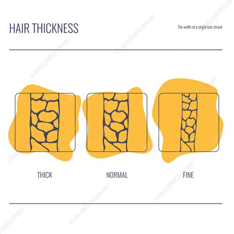 Hair Density Conceptual Illustration Stock Image F0414482