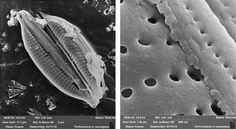 Left Benthic Attached Diatom Halamphora Coffeaeformis View Of The Download Scientific Diagram