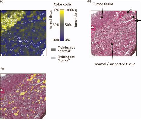 Figure 6 From Infrared Spectroscopic Imaging Of Renal Tumor Tissue Semantic Scholar