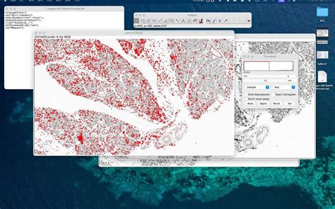 全网最简单免疫组化染色imagej数据统计及批量分析 哔哩哔哩