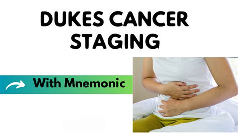 Dukes Cancer Staging For Colorectal Carcinoma With Mnemonic