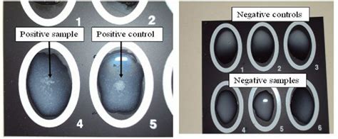 Agglutination Test Results Left Positive Agglutination 4 Positive