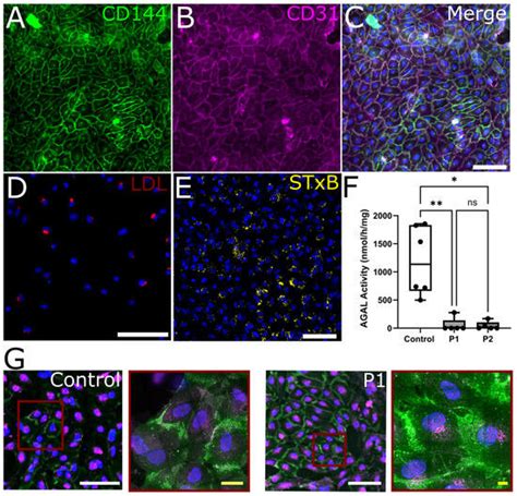 Ijms Free Full Text Endothelial Cell Dysfunction And Hypoxia As