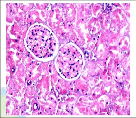 Photomicrograph From A Diabetic Control Rat Showing Diffuse Glomerular Download Scientific