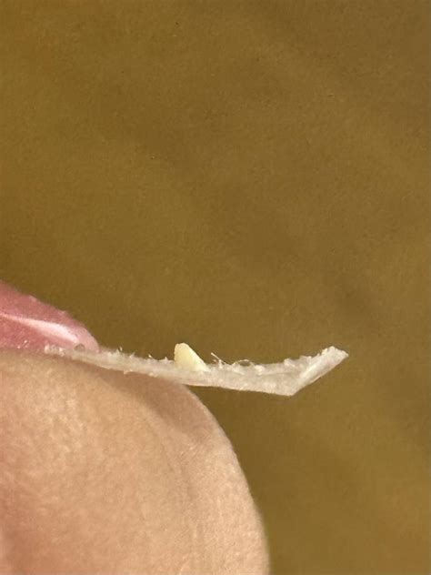 여드름패치 피지 대박이다 인스티즈instiz 일상 카테고리