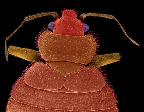 Bed Bug Photograph By Dennis Kunkel Microscopyscience Photo Library