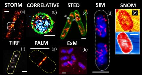 Figure 1 From Super Resolution Optical Imaging Of Bacterial Cells Semantic Scholar