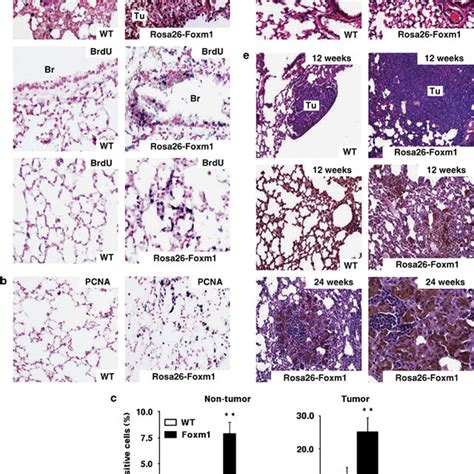 Pdf Transgenic Expression Of The Forkhead Box M Transcription Factor Induces Formation Of