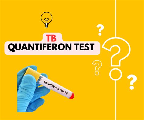 QuantiFERON Test QFT For Tuberculosis Dr Ankit Parakh India S