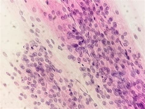 Microscopic View Of Trichomonas Vaginalis In Pap Smear With Few Acute