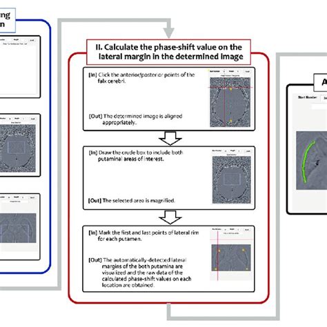 Detailed Process Of The Algorithm Dark And White Signals Indicate High
