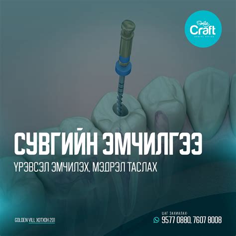 Smile Манай эмнэлэгт дараах үйлчилгээ ХӨНГӨЛӨЛТТЭЙ ҮНЭЭР хийгдэж байна Риббонд авагддаггүй