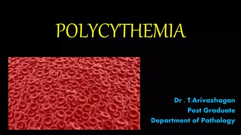 Polycythemia Pptx