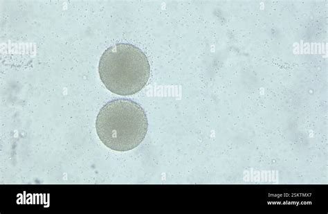 Sperm And Ovule Sea Urchin Strongylocentrotus Pallidus Under Microscope