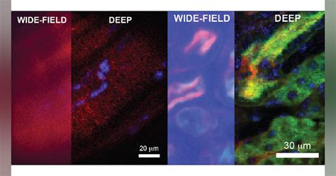 Computational And Nir Imaging Increase Wide Field Microscopy Depth And