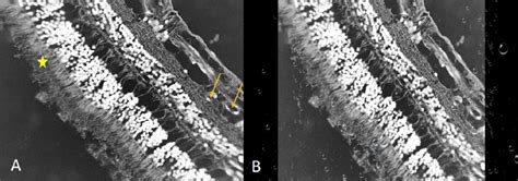Hematoxylin Eosin H E Stained Histological Section Of Human Retina