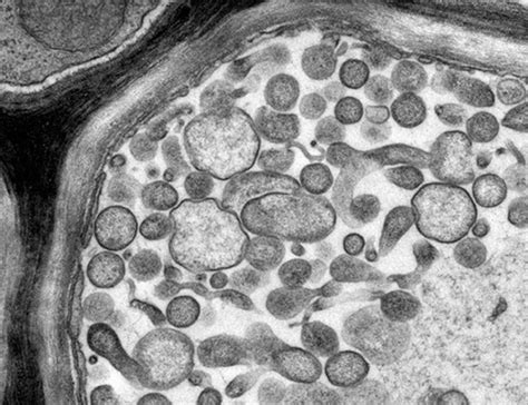 A Phytoplasma On Our Pine Perhaps