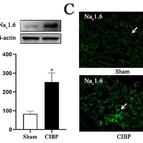 The Expression Of Nav16 Is Increased In The Drg Of Rats With Cibp A